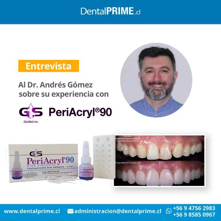 Dr. Andrés Gómez: “Periacryl es un producto seguro y que da una mayor ...